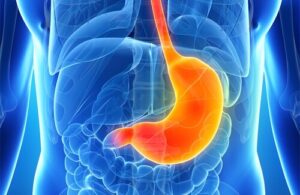 Gastritis with Neurotherapy: Natural Solutions for Digestive Health